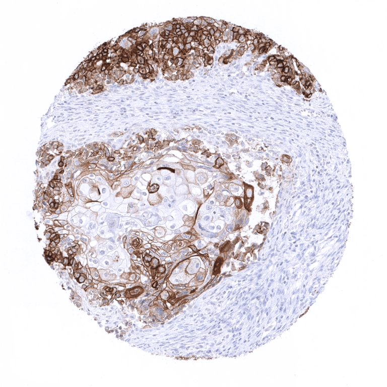 Cancer Tissue Gallery DOG-1 - MS Validated Antibodies