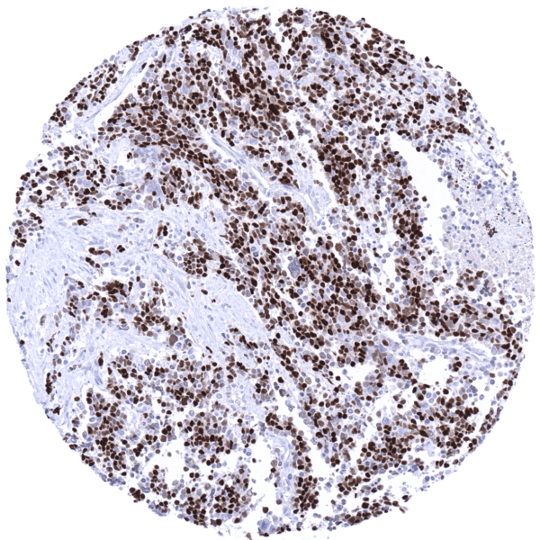INSM1 (MSVA-456R) - MS Validated Antibodies