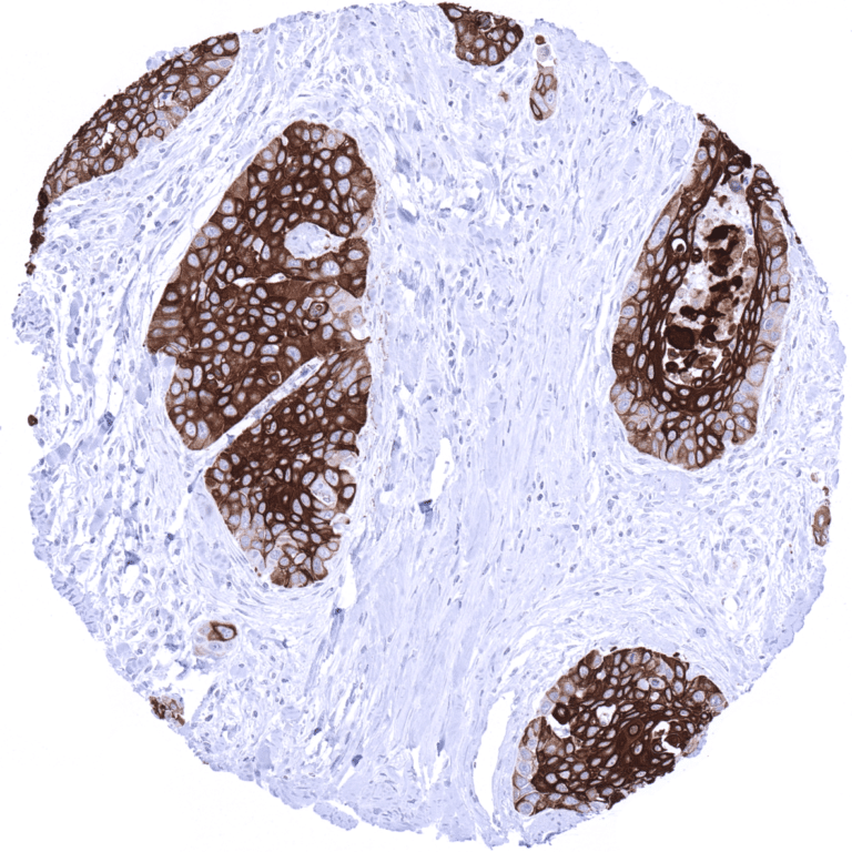 Cancer Tissue Gallery Cytokeratin 13 - MS Validated Antibodies