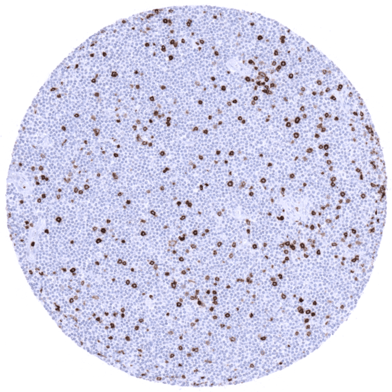 Cancer Tissue Gallery CD7 - MS Validated Antibodies