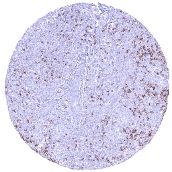 CD45RA (MSVA-472M) - MS Validated Antibodies