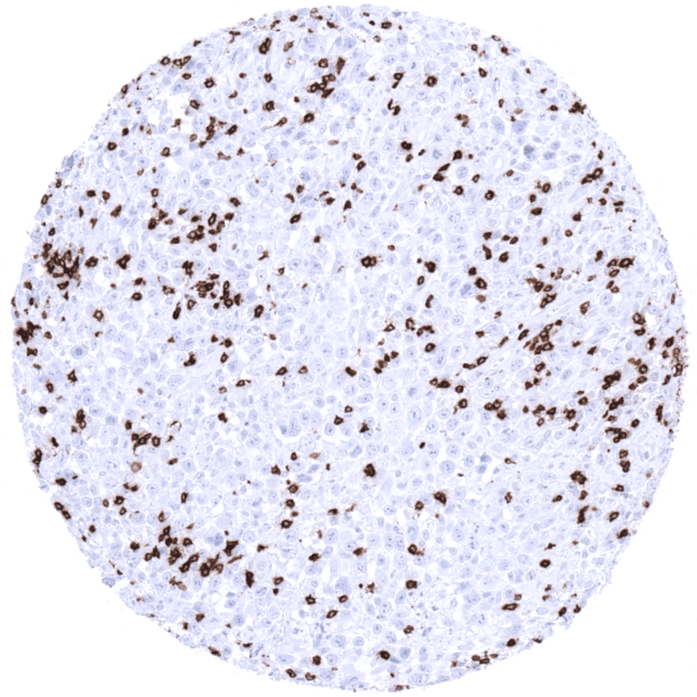 Cancer Tissue Gallery CD7 - MS Validated Antibodies