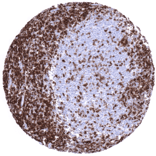 Cancer Tissue Gallery CD7 - MS Validated Antibodies