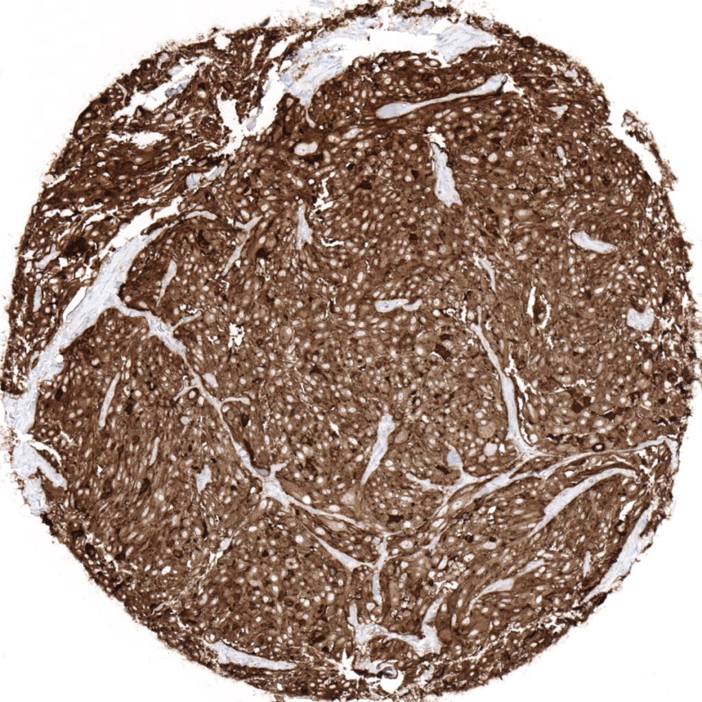 CEA / CD66e / CEACAM5 (MSVA-465R) - MS Validated Antibodies