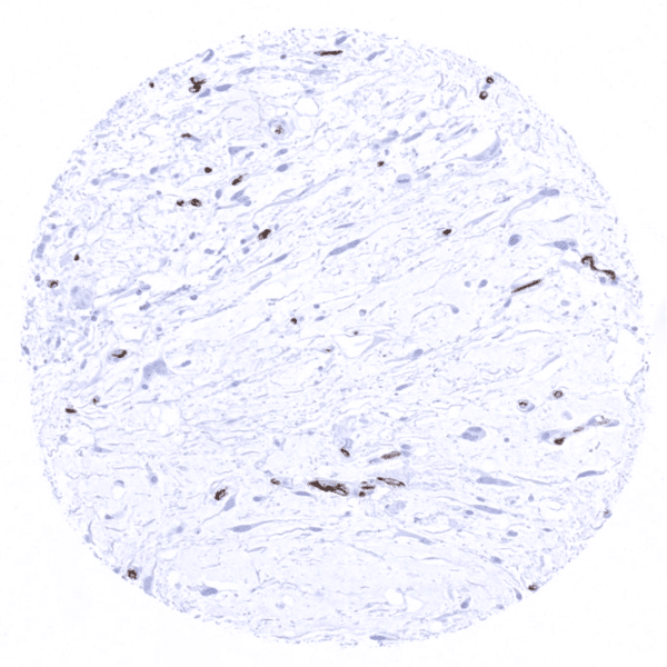 Cancer Tissue Gallery CD34 - MS Validated Antibodies