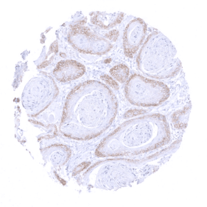 Cancer Tissue Gallery DOG-1 - MS Validated Antibodies