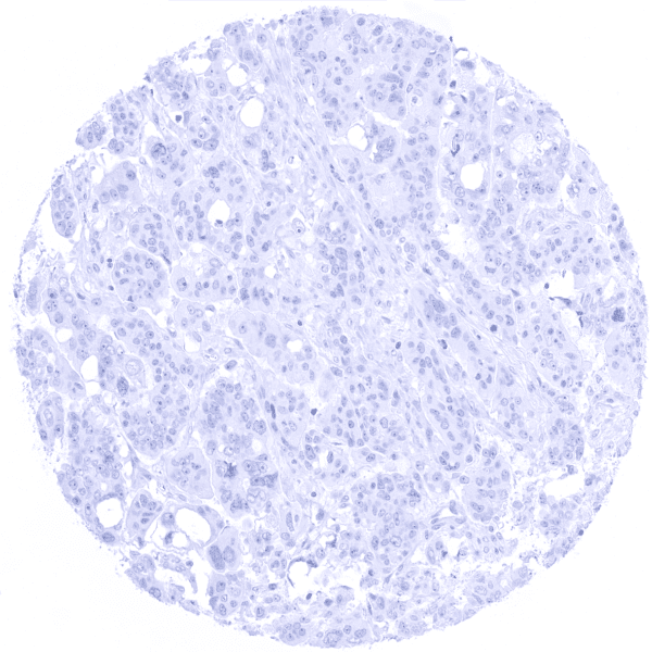 Cancer Tissue Gallery MUC6 - MS Validated Antibodies