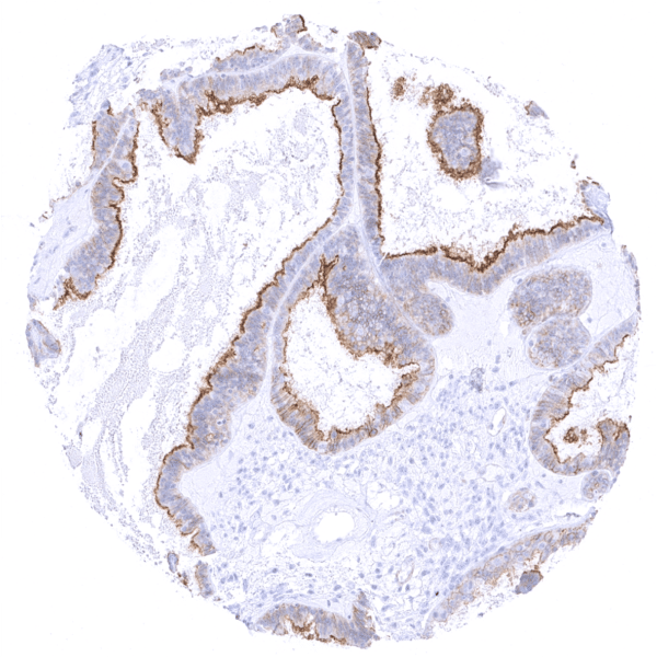 Cancer Tissue Gallery DOG-1 - MS Validated Antibodies