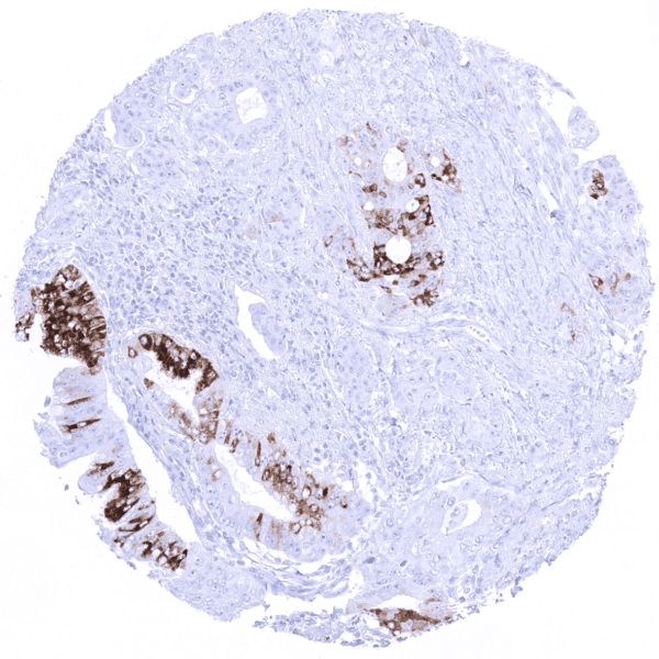 Cancer Tissue Gallery MUC6 - MS Validated Antibodies