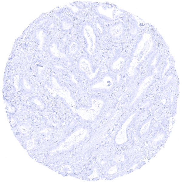 Cancer Tissue Gallery Cytokeratin 13 - MS Validated Antibodies