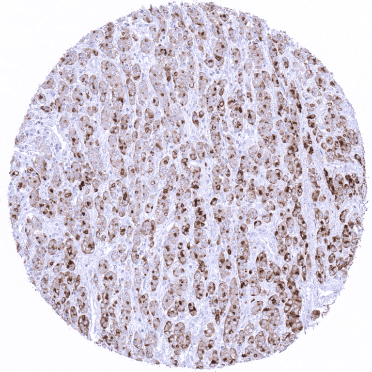 Cancer Tissue Gallery PSAP - MS Validated Antibodies