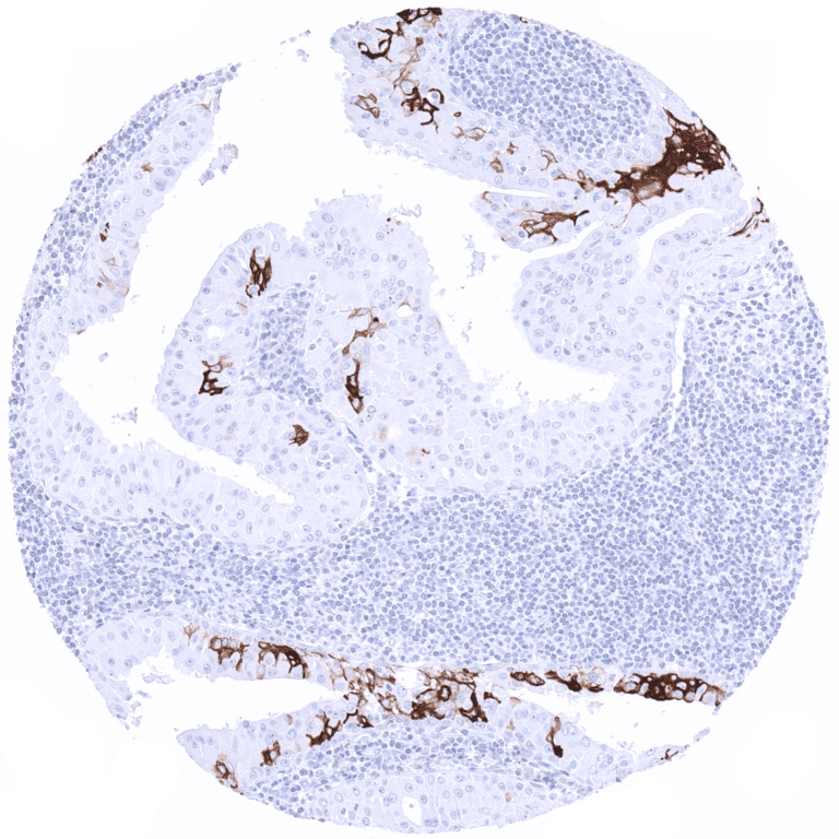 Cancer Tissue Gallery Cytokeratin 13 - MS Validated Antibodies