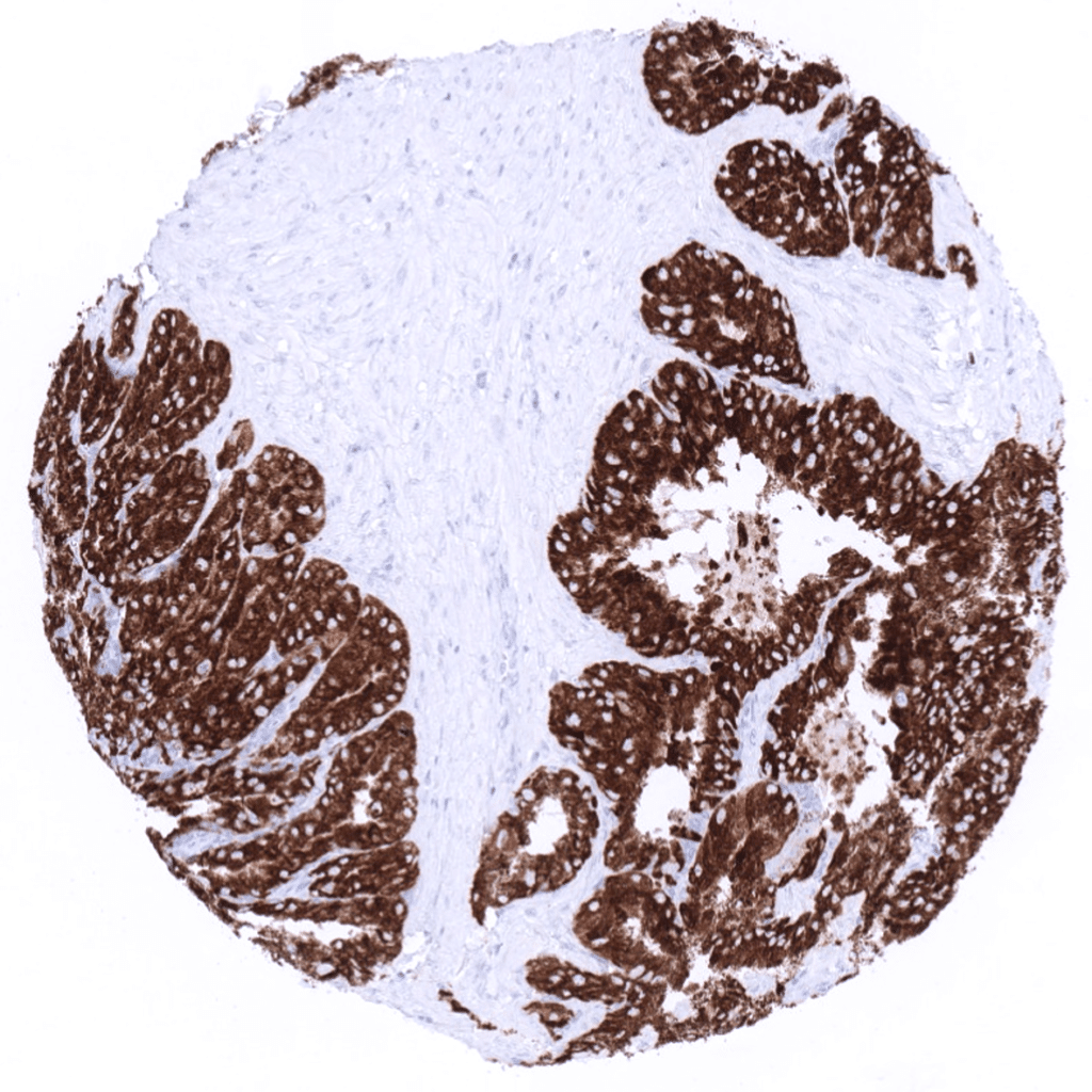 MUC6 (MSVA-806R) - MS Validated Antibodies