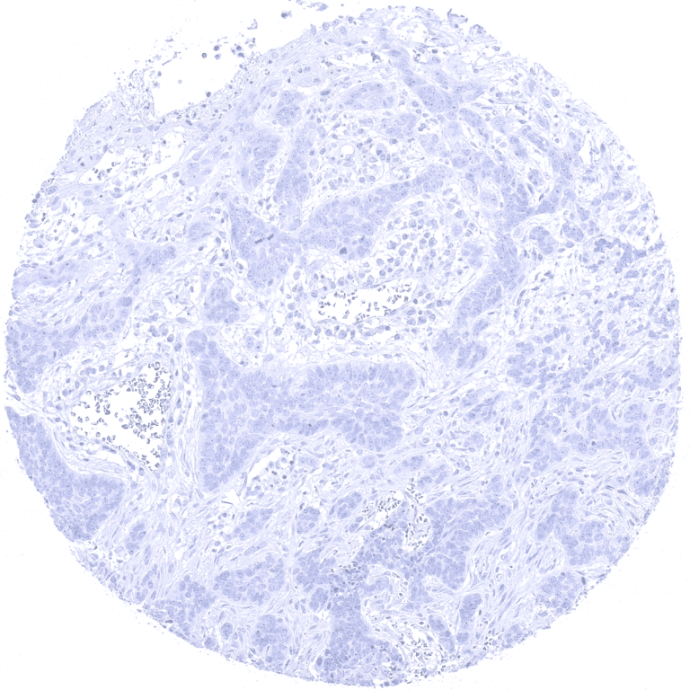 Cancer Tissue Gallery Cytokeratin 13 - MS Validated Antibodies