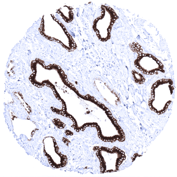 Cancer Tissue Gallery MUC6 - MS Validated Antibodies