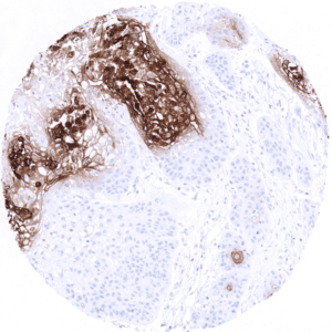 Cancer Tissue Gallery CEA - MS Validated Antibodies
