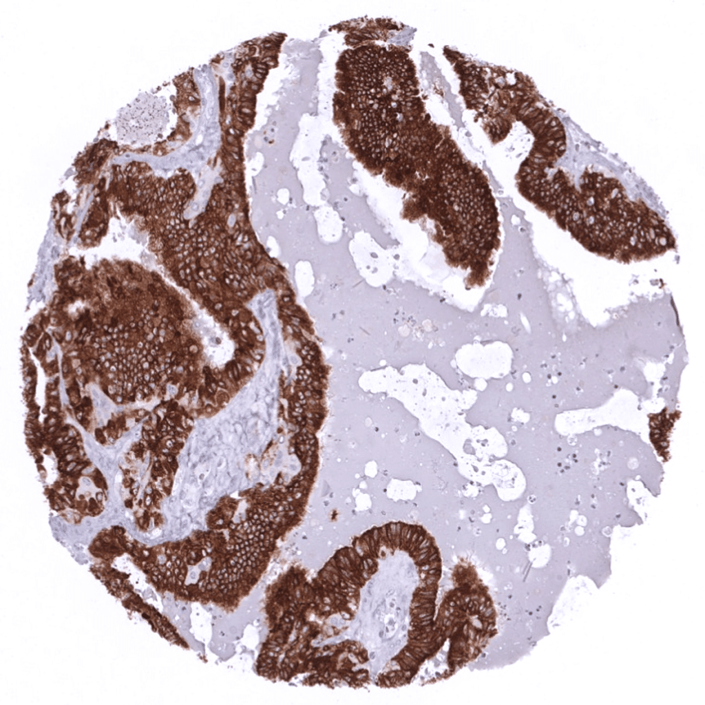 MUC6 (MSVA-806R) - MS Validated Antibodies