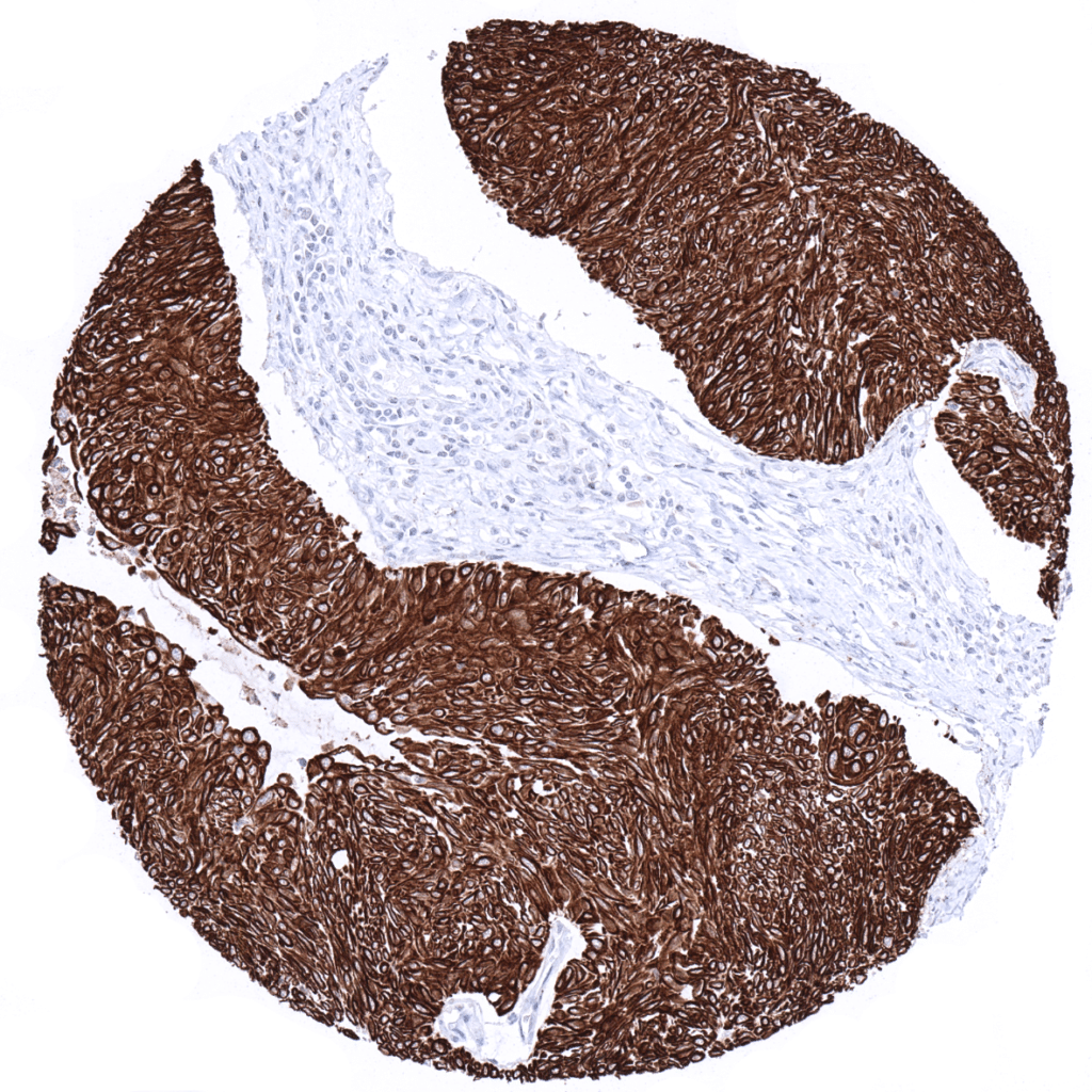 Cytokeratin 13 (MSVA-613M) - MS Validated Antibodies
