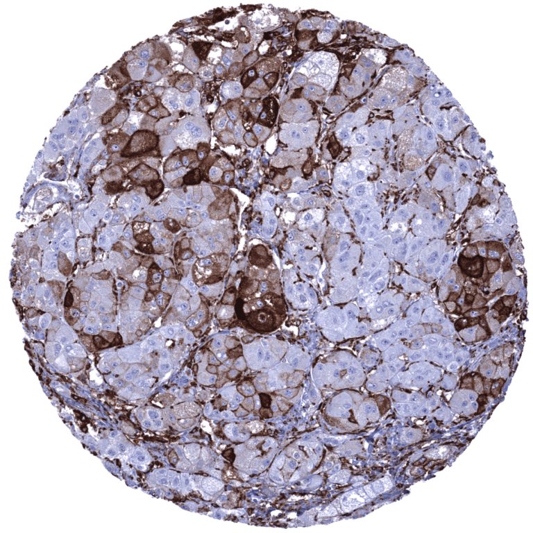 Cancer Tissue Gallery HLA-DRa - MS Validated Antibodies