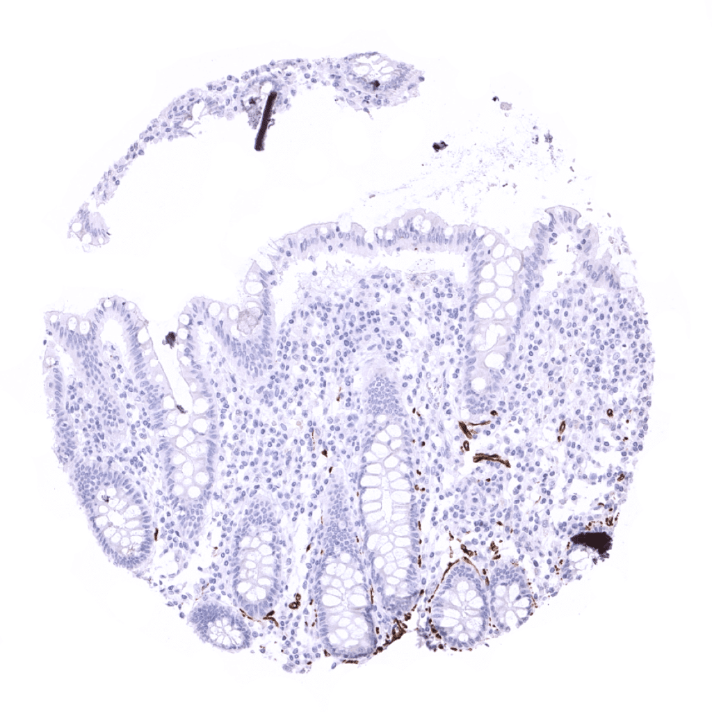 Desmin (MSVA-651M) - MS Validated Antibodies