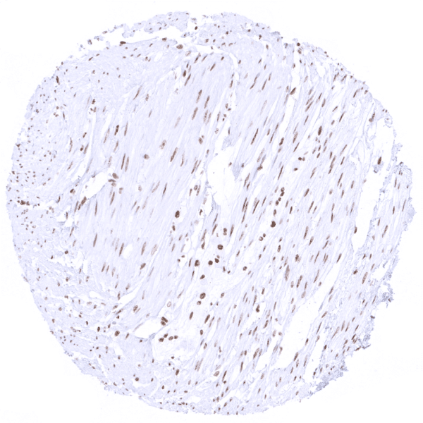 Normal Tissue Gallery MSH6 - MS Validated Antibodies