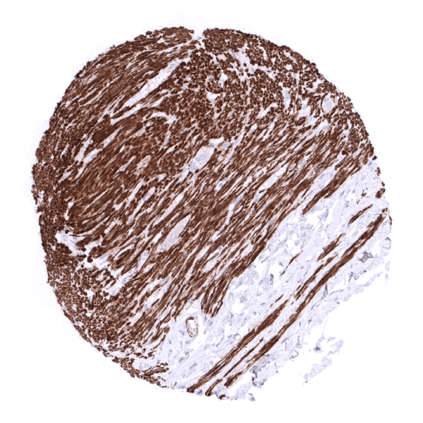Normal Tissue Gallery Desmin - MS Validated Antibodies