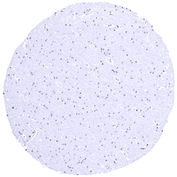 Normal Tissue Gallery MSH6 - MS Validated Antibodies