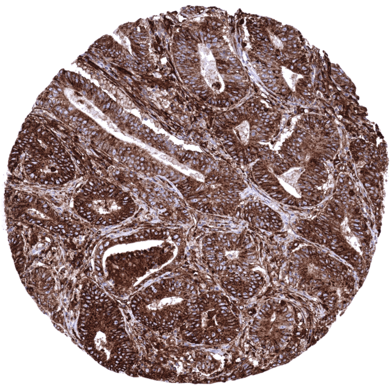 Cancer Tissue Gallery HLA-DRa - MS Validated Antibodies