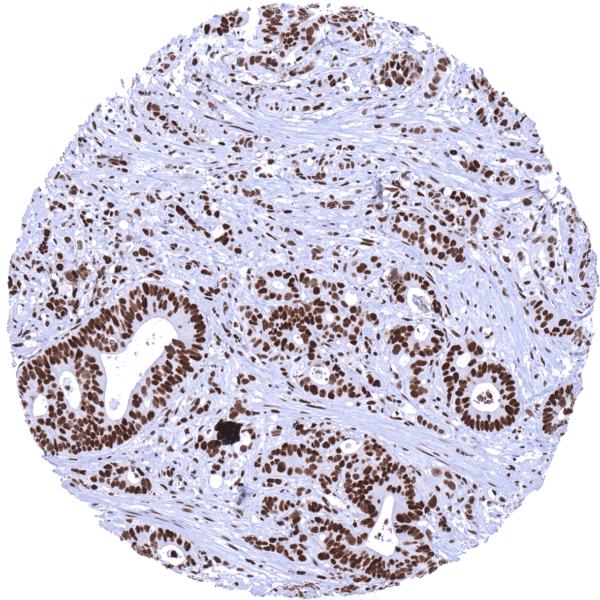 Cancer Tissue Gallery MSH2 - MS Validated Antibodies