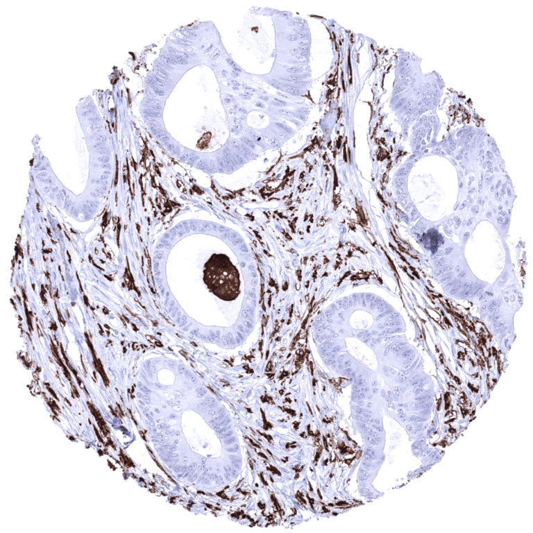 Cancer Tissue Gallery HLA-DRa - MS Validated Antibodies