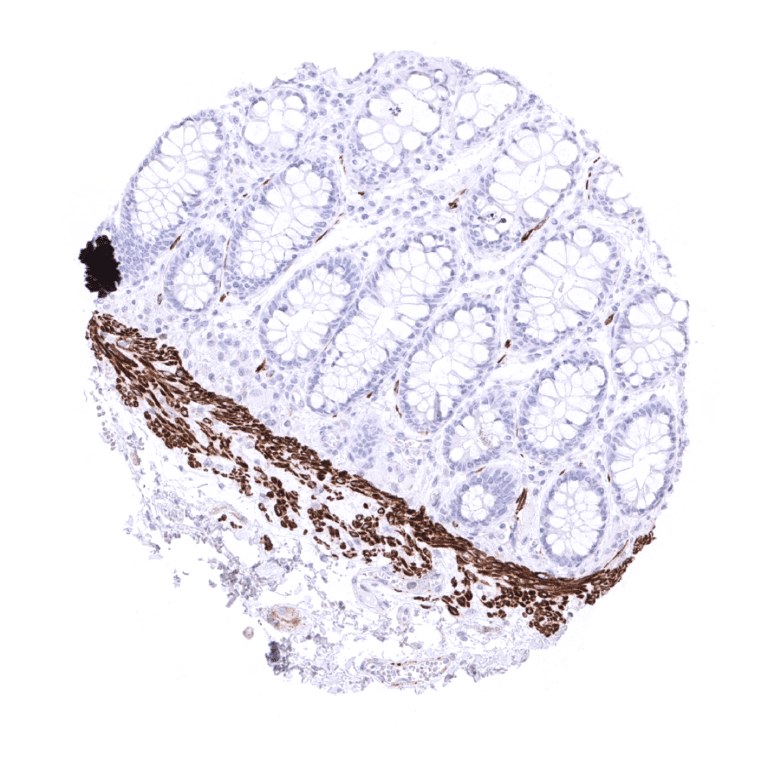 Normal Tissue Gallery Desmin - MS Validated Antibodies
