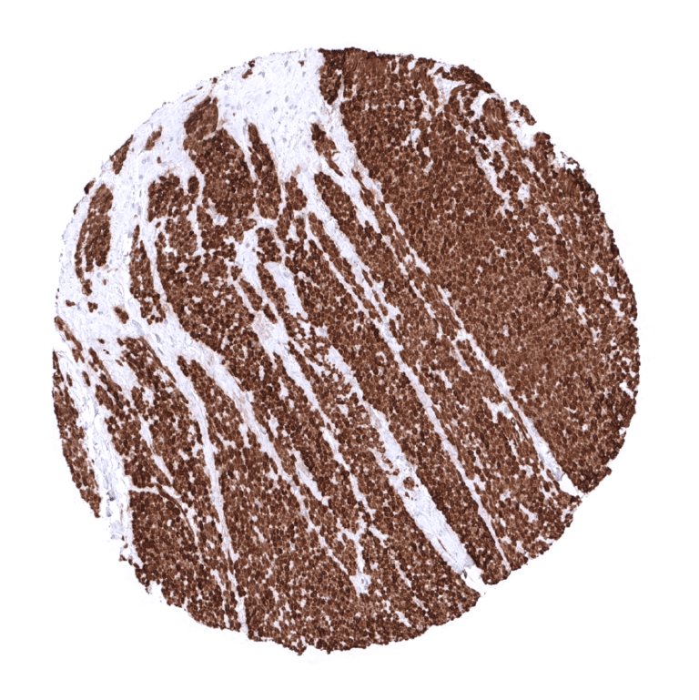 Normal Tissue Gallery Desmin - MS Validated Antibodies