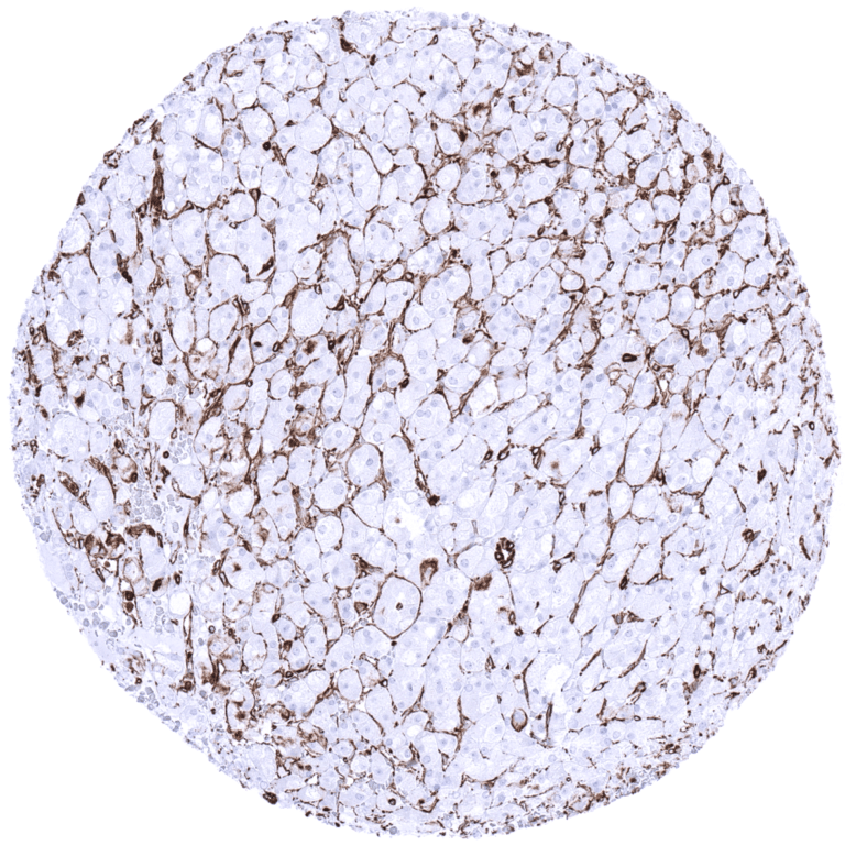 Cancer Tissue Gallery Vimentin - MS Validated Antibodies