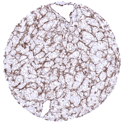 Cancer Tissue Gallery Vimentin - MS Validated Antibodies