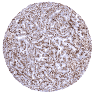 Cancer Tissue Gallery Vimentin - MS Validated Antibodies