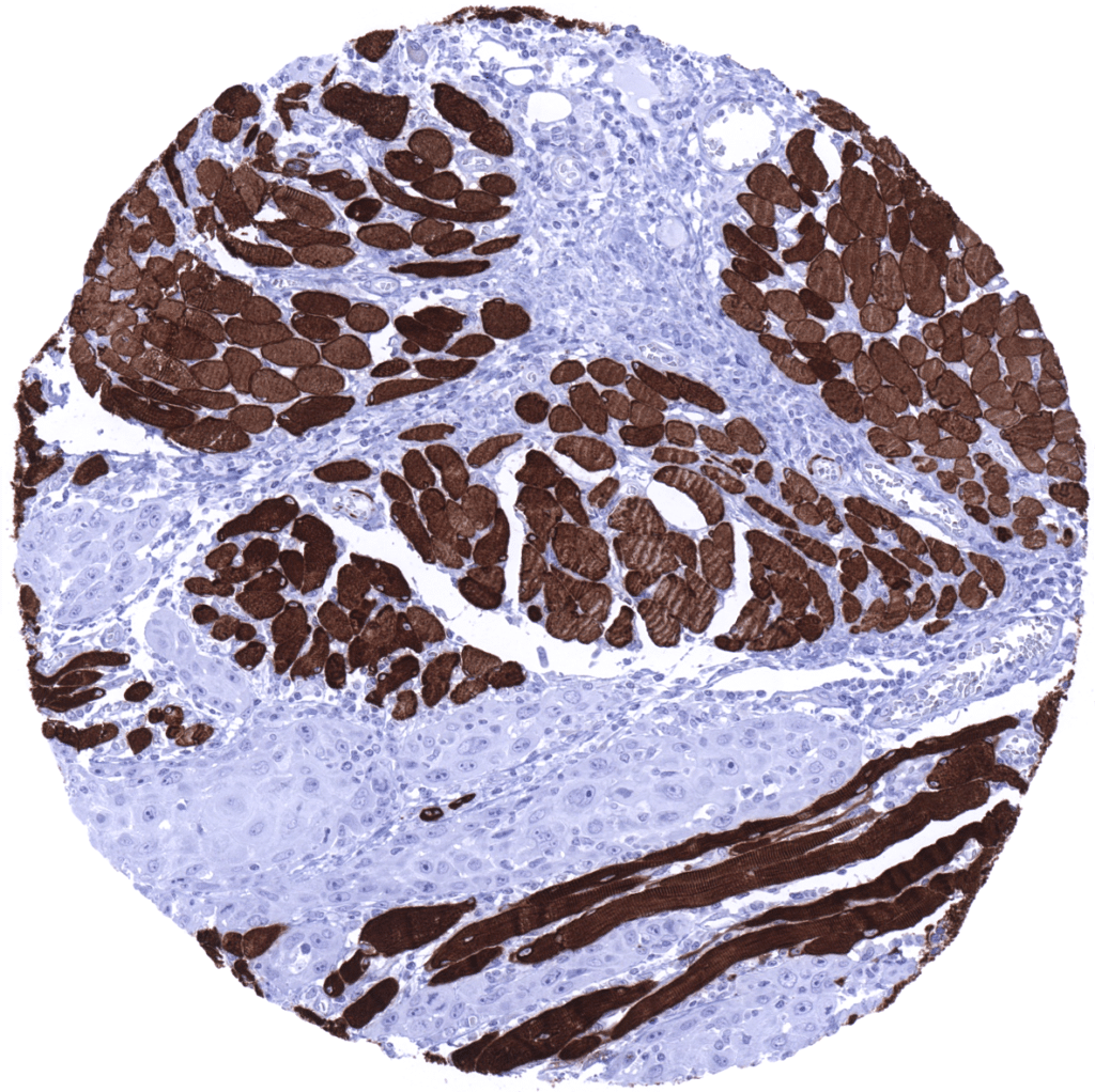 Desmin (MSVA-651M) - MS Validated Antibodies