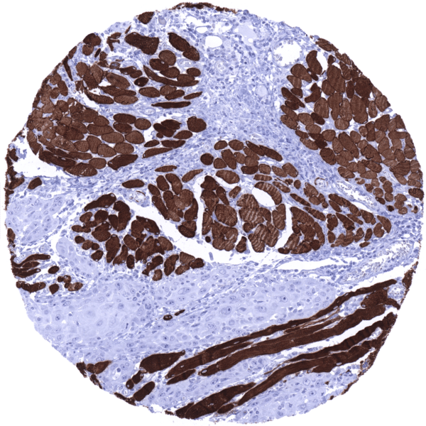 Desmin (MSVA-651M) - MS Validated Antibodies