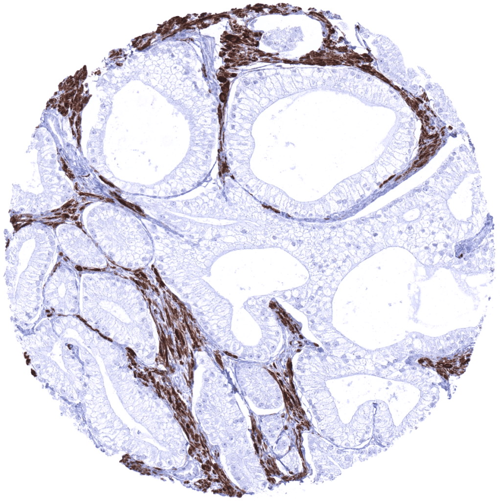Desmin (MSVA-651M) - MS Validated Antibodies