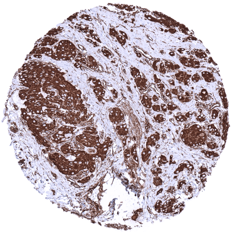 Cancer Tissue Gallery Vimentin - MS Validated Antibodies