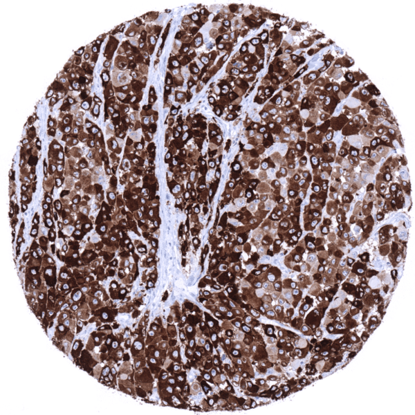 Cancer Tissue Gallery Melan A Specific - MS Validated Antibodies