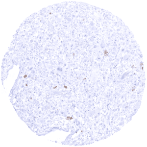 Cancer Tissue Gallery Desmin - MS Validated Antibodies