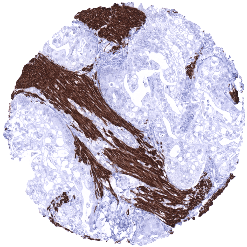 Desmin (MSVA-651M) - MS Validated Antibodies