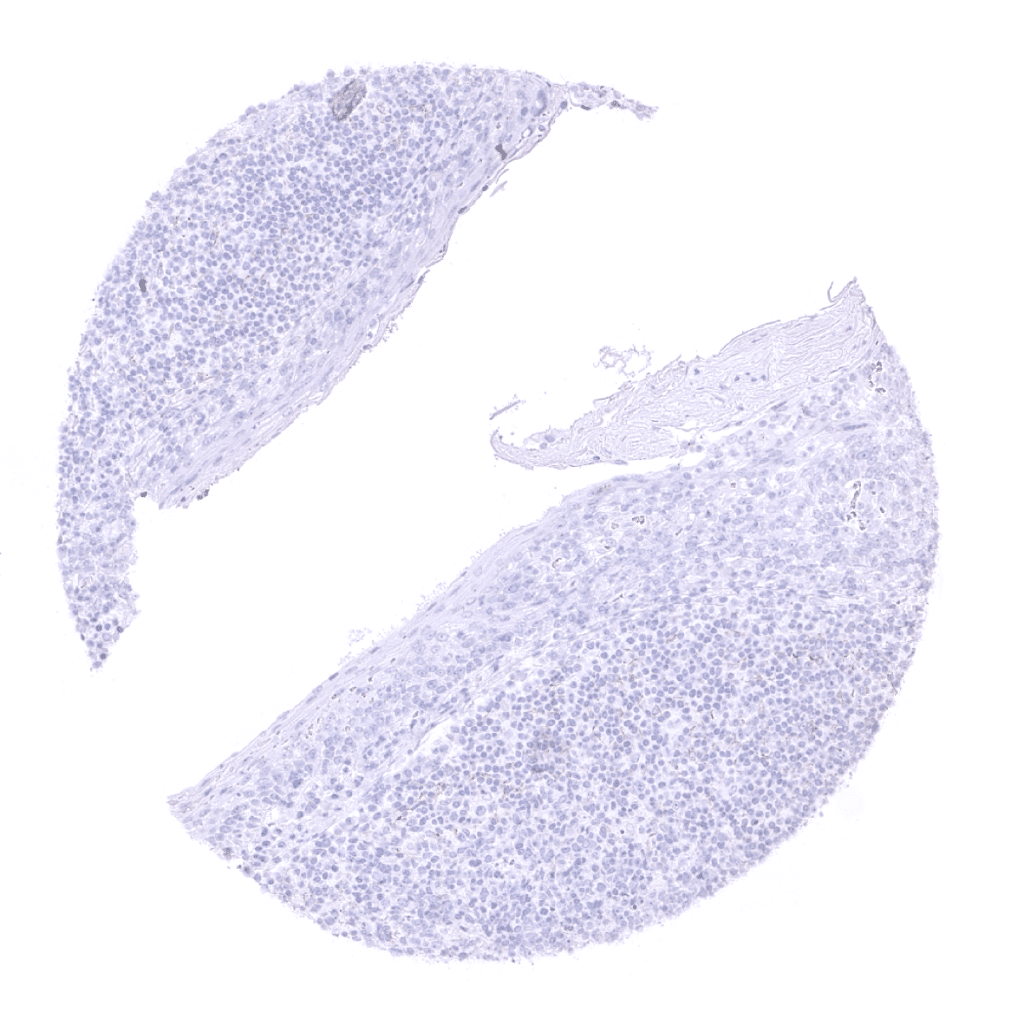 Desmin (MSVA-651M) - MS Validated Antibodies