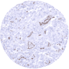 Cancer Tissue Gallery CD31 - MS Validated Antibodies