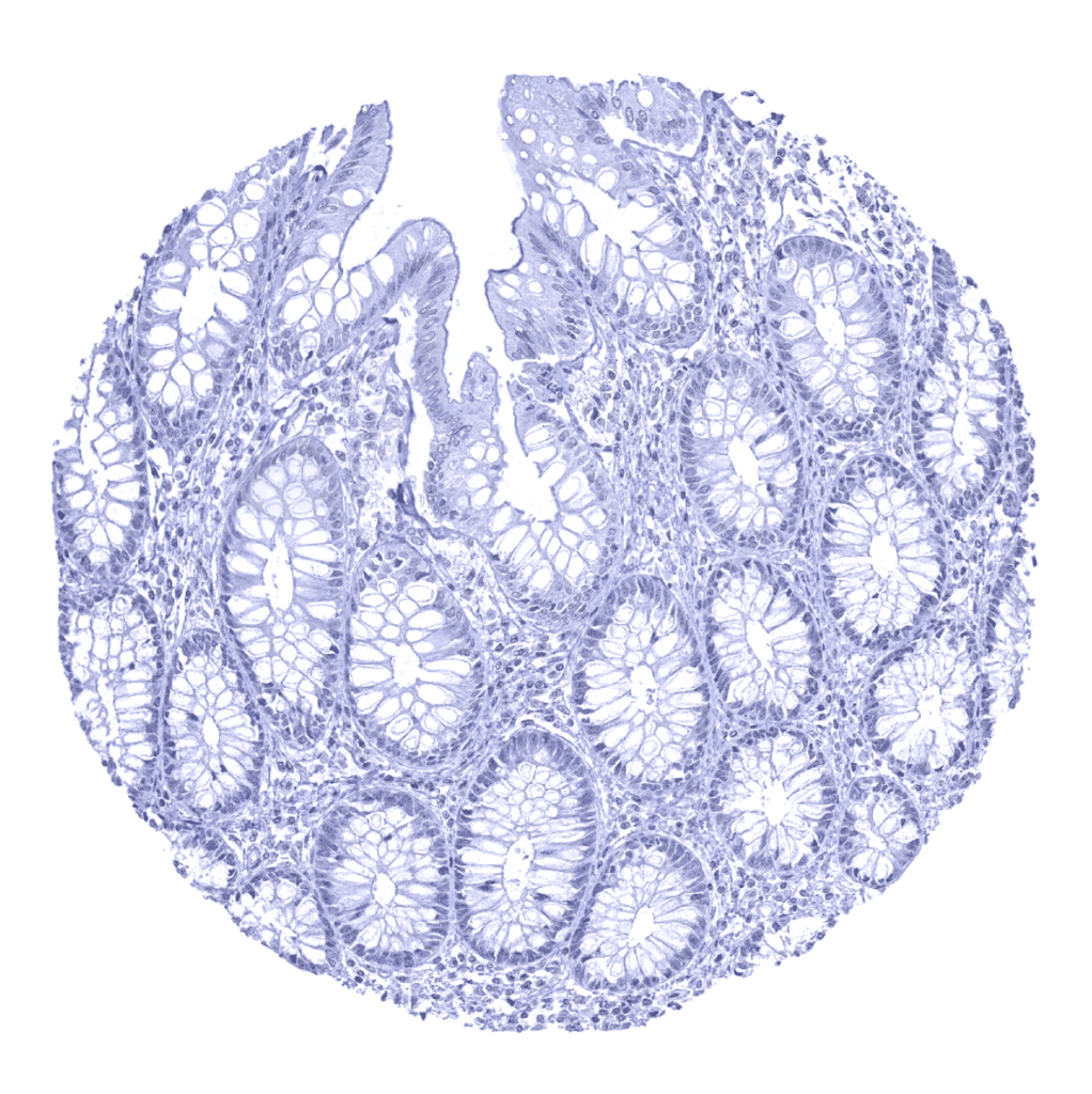 Androgen Receptor (MSVA-367R) - MS Validated Antibodies