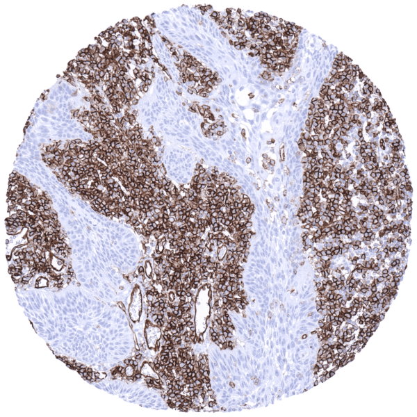 Cancer Tissue Gallery CD31 - MS Validated Antibodies