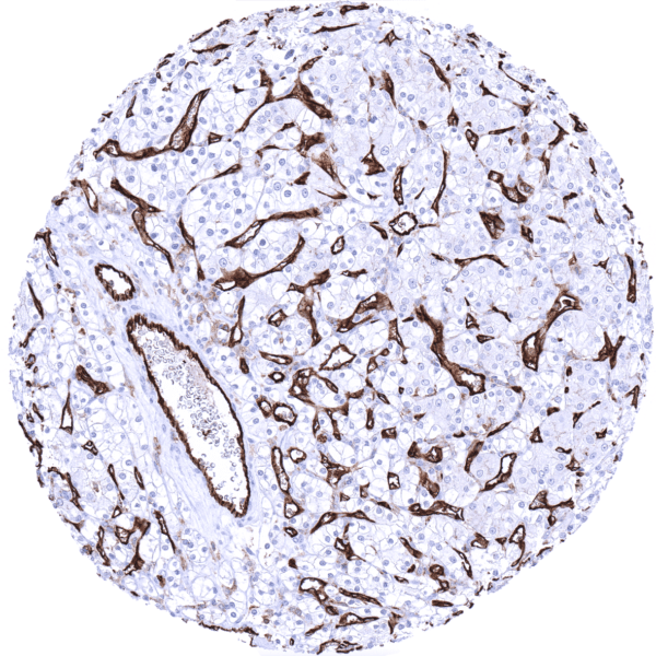 Cancer Tissue Gallery CD31 - MS Validated Antibodies