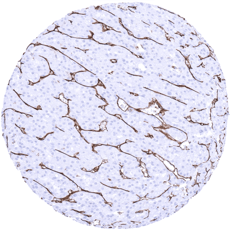 Cancer Tissue Gallery CD31 - MS Validated Antibodies