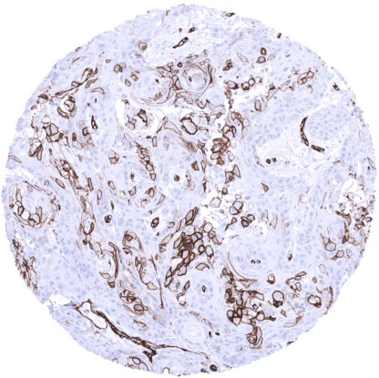 Cancer Tissue Gallery CD31 - MS Validated Antibodies