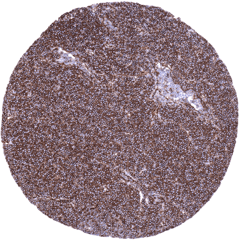 Cancer Tissue Gallery CD31 - MS Validated Antibodies